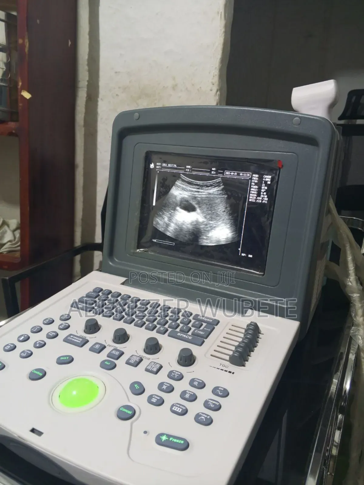 Ultra Sound in Adama - Medical Equipment & Supplies, Abenezer Wubete ...